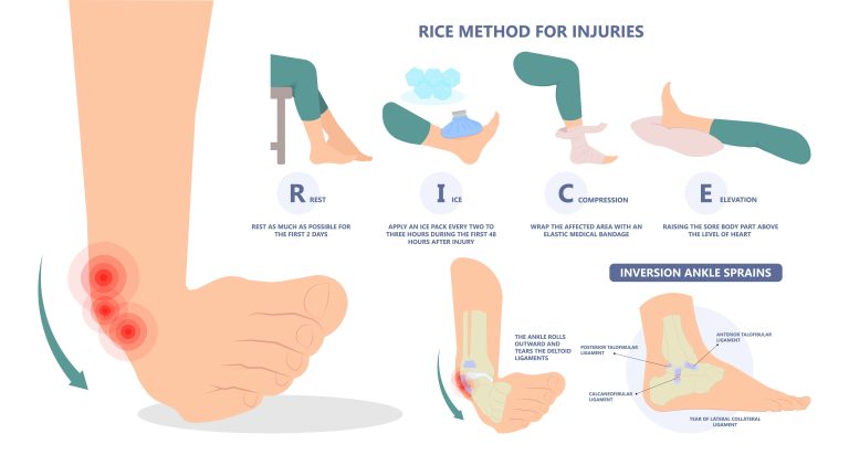 Inverted Ankle - Rehab 49