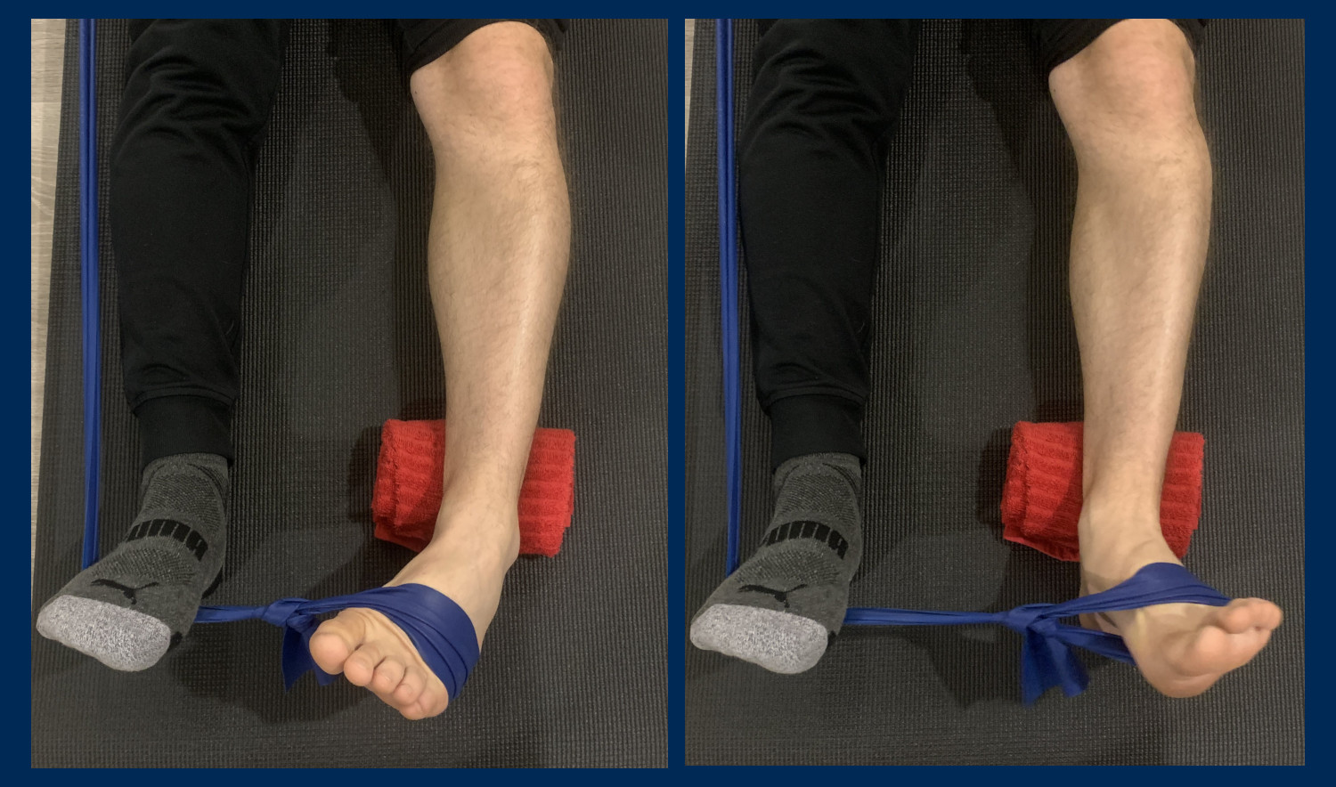 Inverted Ankle - Rehab 49