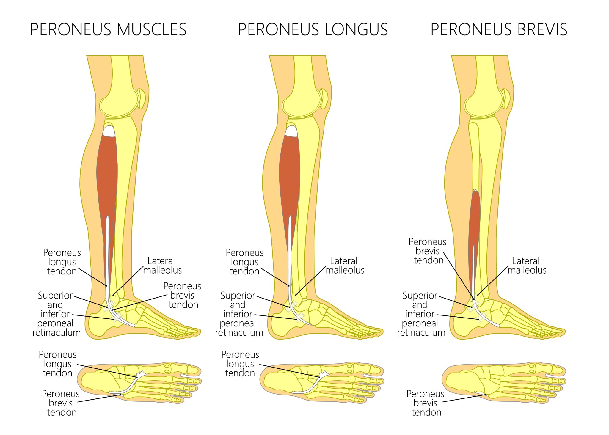 Inverted Ankle - Rehab 49