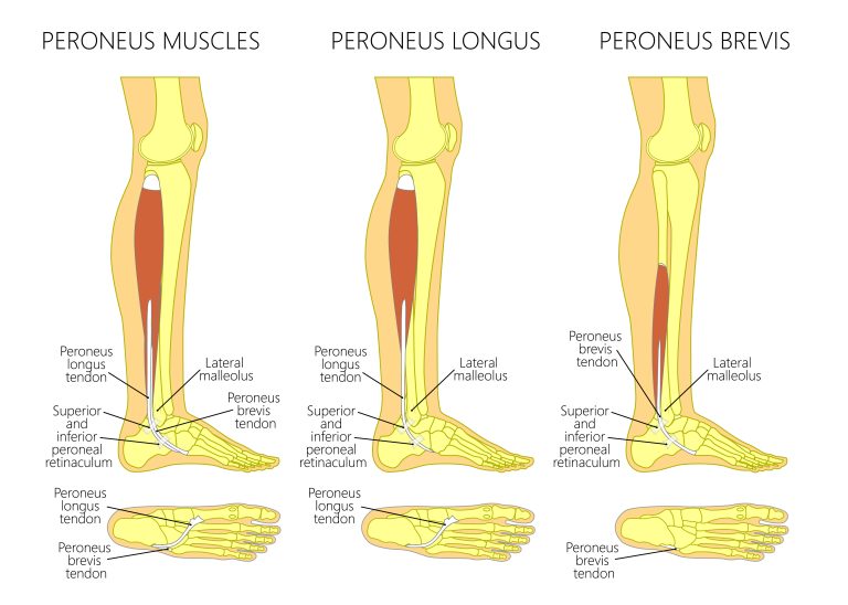 Inverted Ankle - Rehab 49