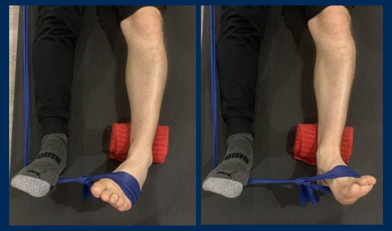 Cardio With a Sprained Ankle - Rehab 49