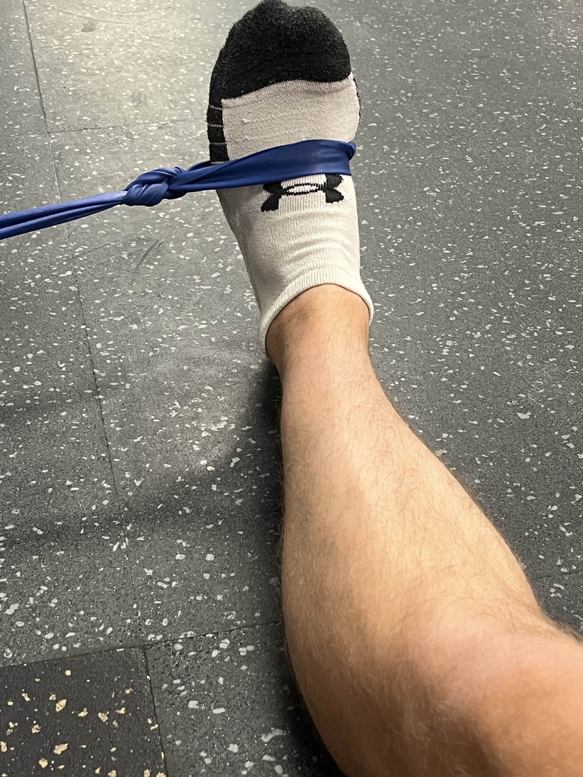 Plantar Fasciitis After a Sprained Ankle - Rehab 49