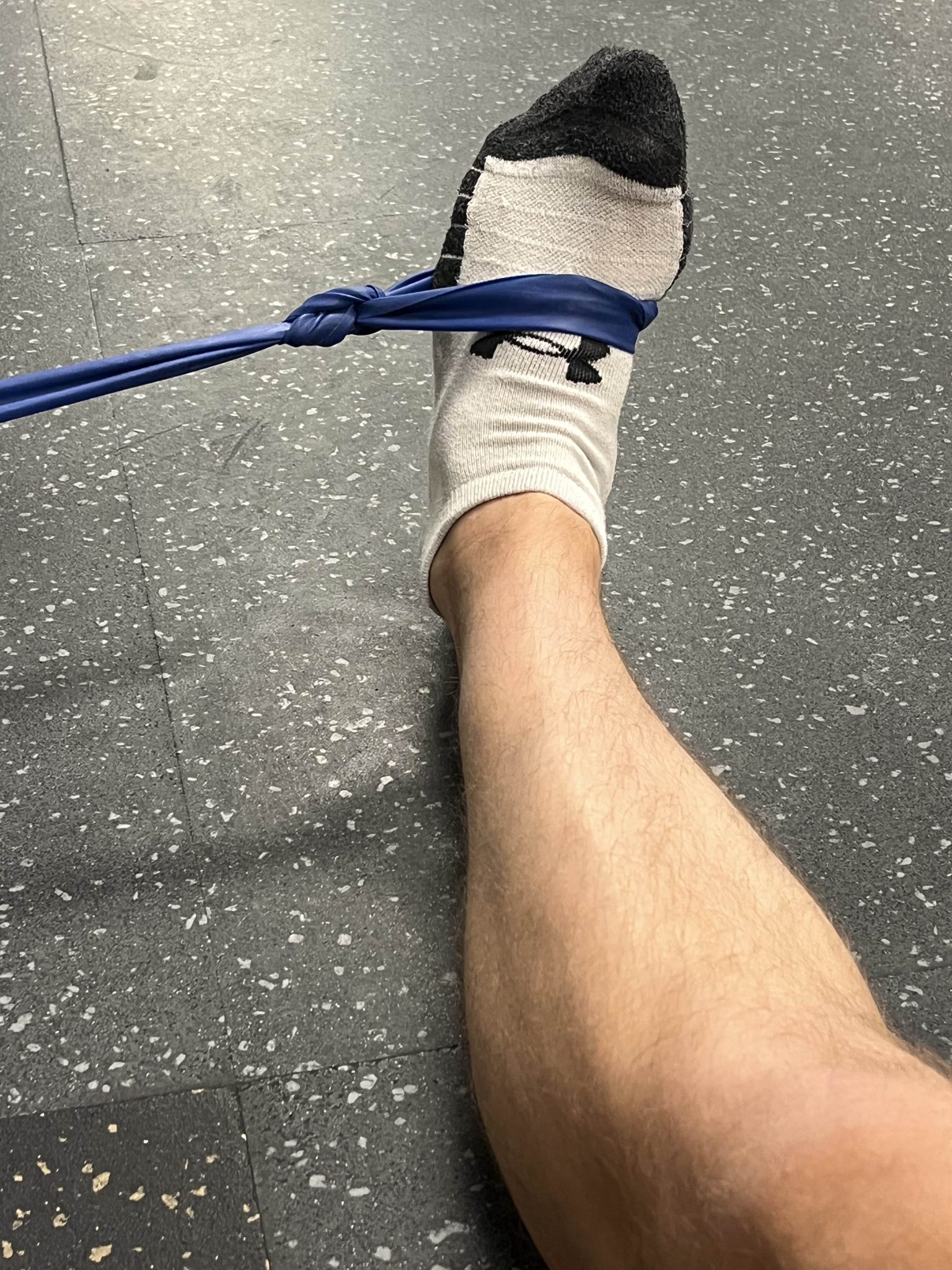 Plantar Fasciitis After a Sprained Ankle - Rehab 49