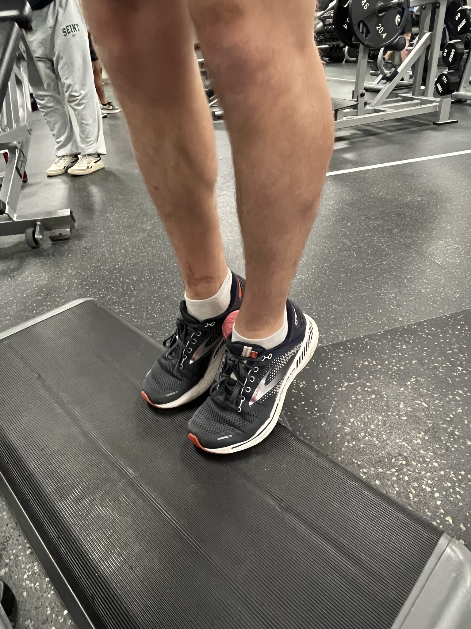 Plantar Fasciitis After a Sprained Ankle - Rehab 49