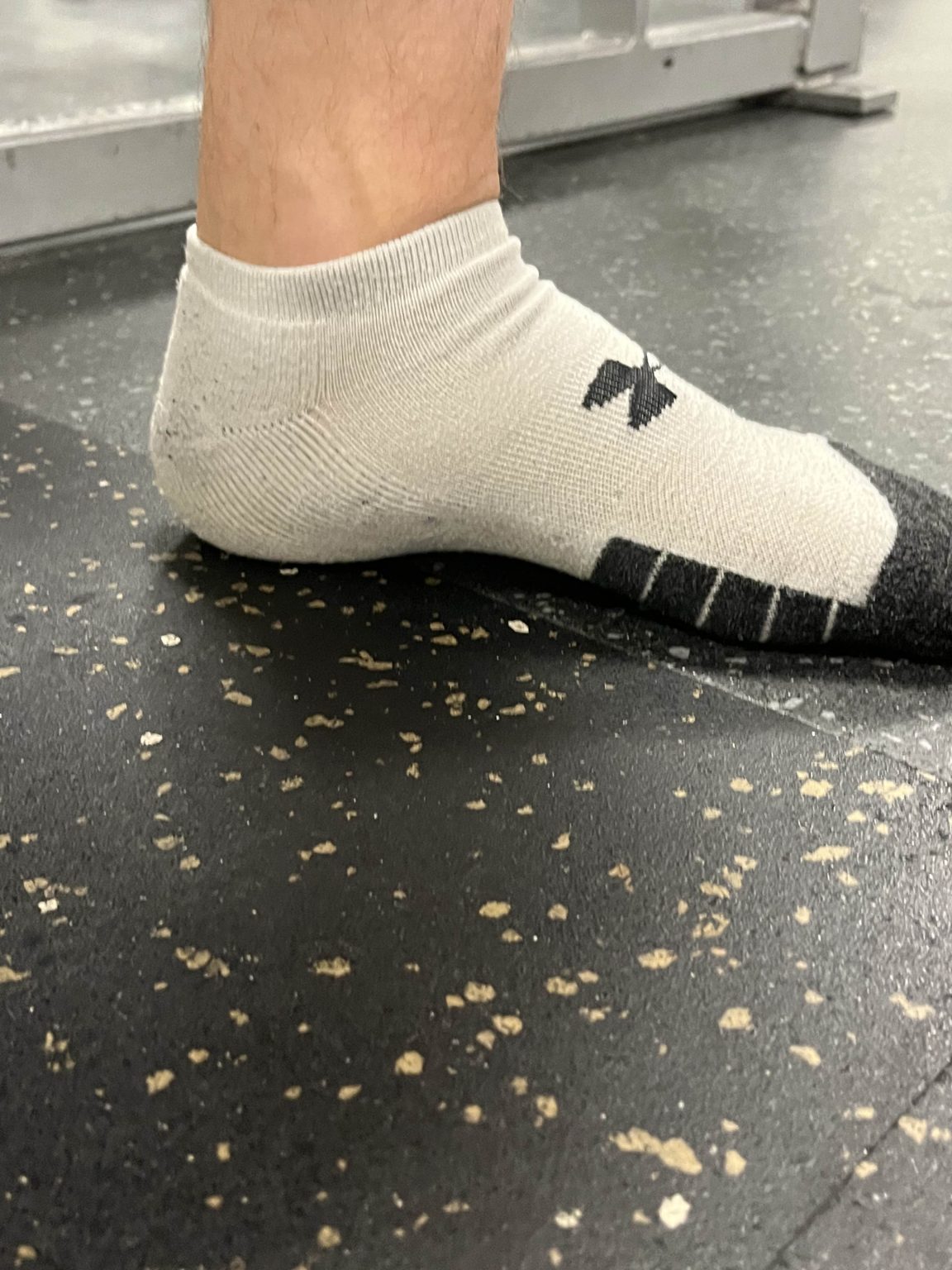 Plantar Fasciitis After a Sprained Ankle - Rehab 49