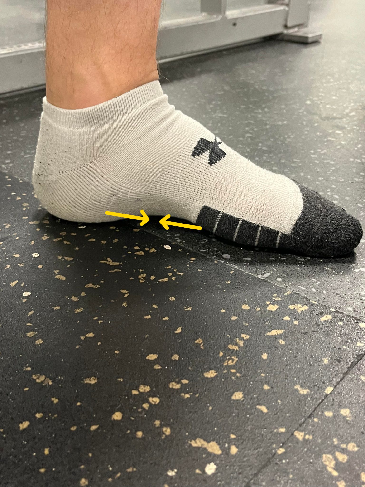 Overpronation and Knee Pain - Rehab 49